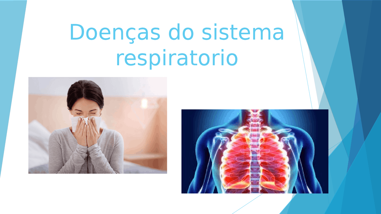 Trabalho Sobre Doenças Do Sistema Respiratório Docsity