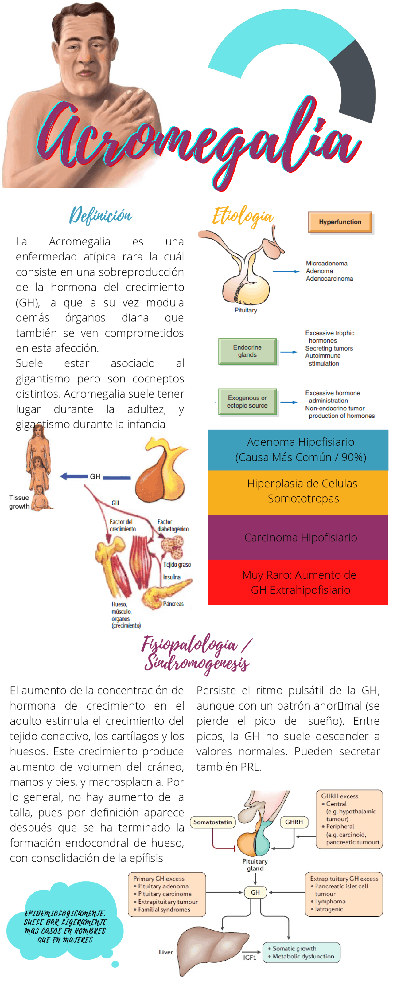 Infografía Acerca De Acromegalia Docsity