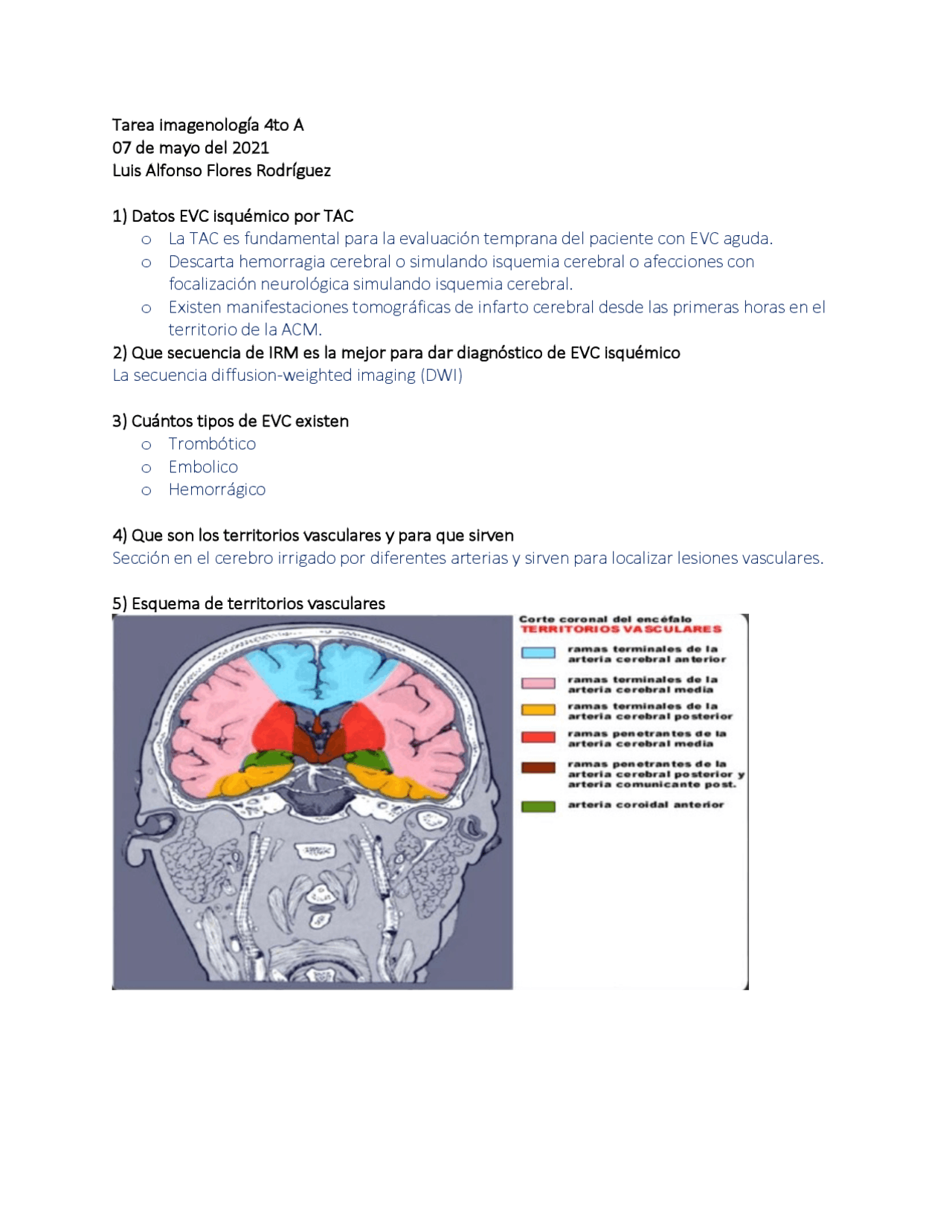 Evento cerebral vascular isquemico | Apuntes de Imagenología | Docsity
