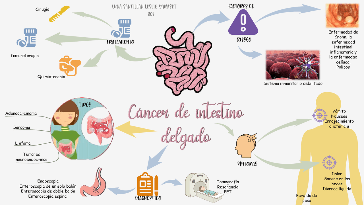Cáncer de intestino delgado | Esquemas y mapas conceptuales de ...