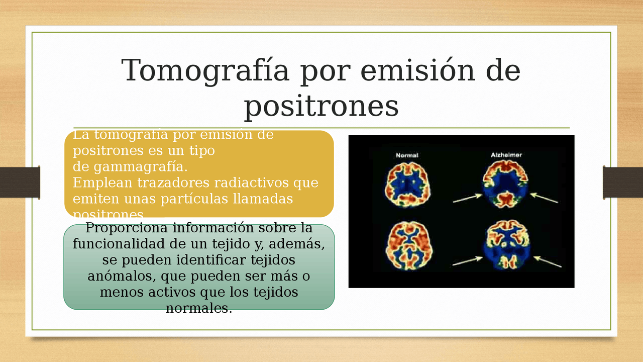 Tomografia por emision de positrones - Docsity