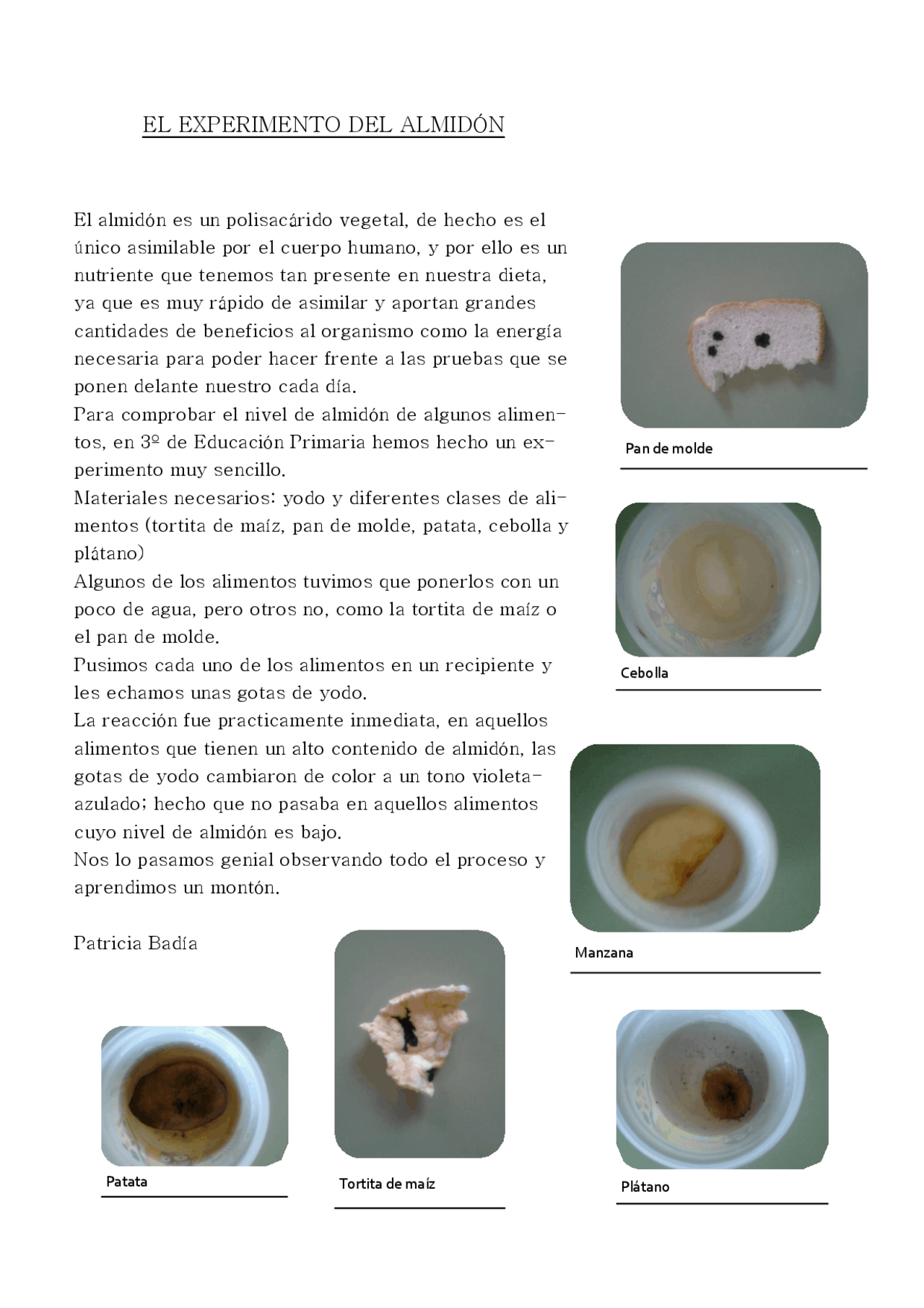 Tarea De Almidon De Bioquimica Notes De Biochimie Docsity