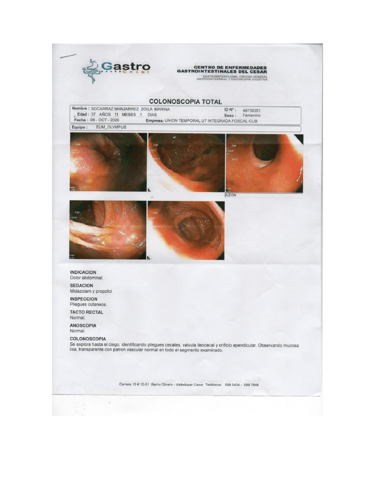 Colonoscopia un procedimiento muy util - Docsity