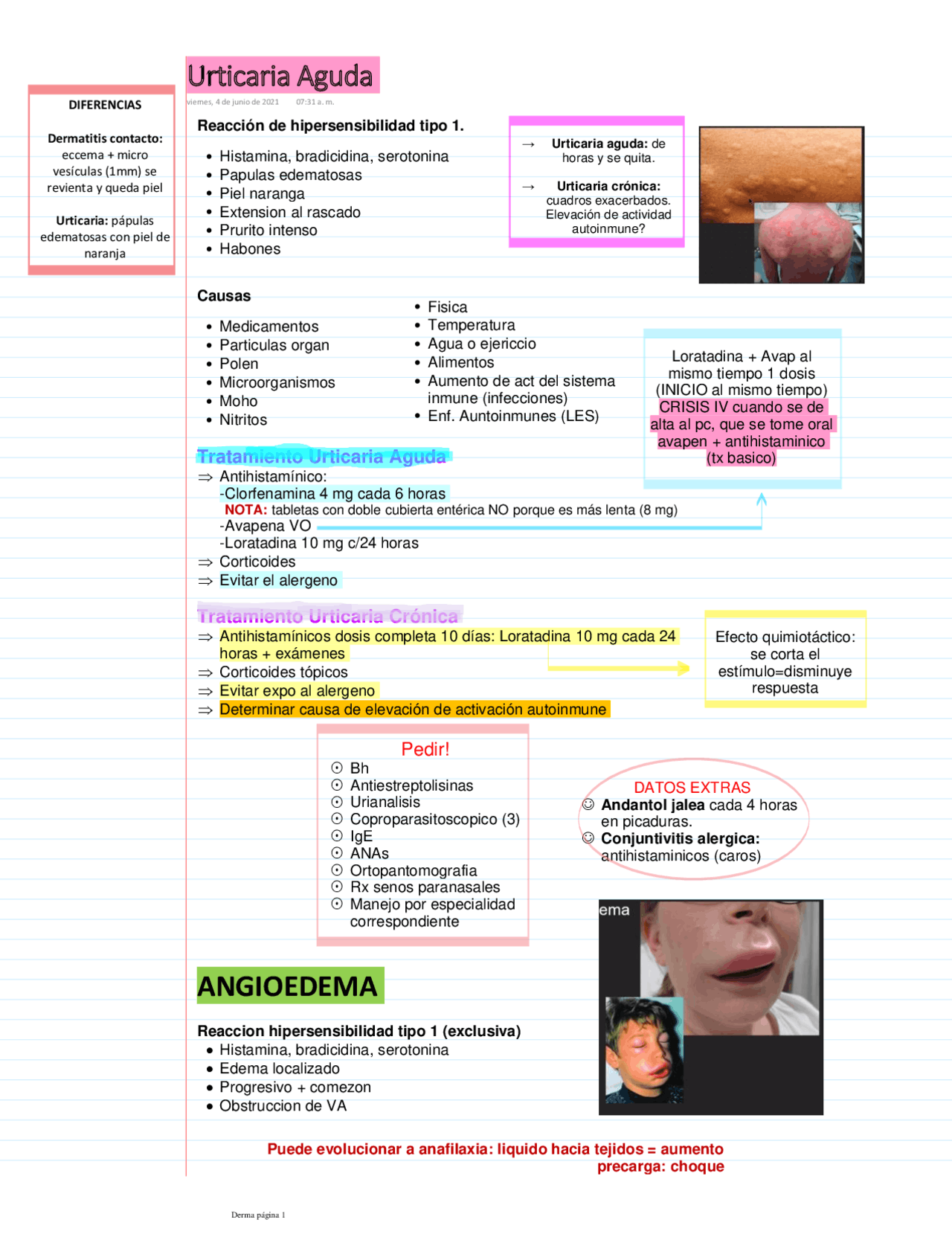 Urticaria Aguda y Angioedema - Docsity