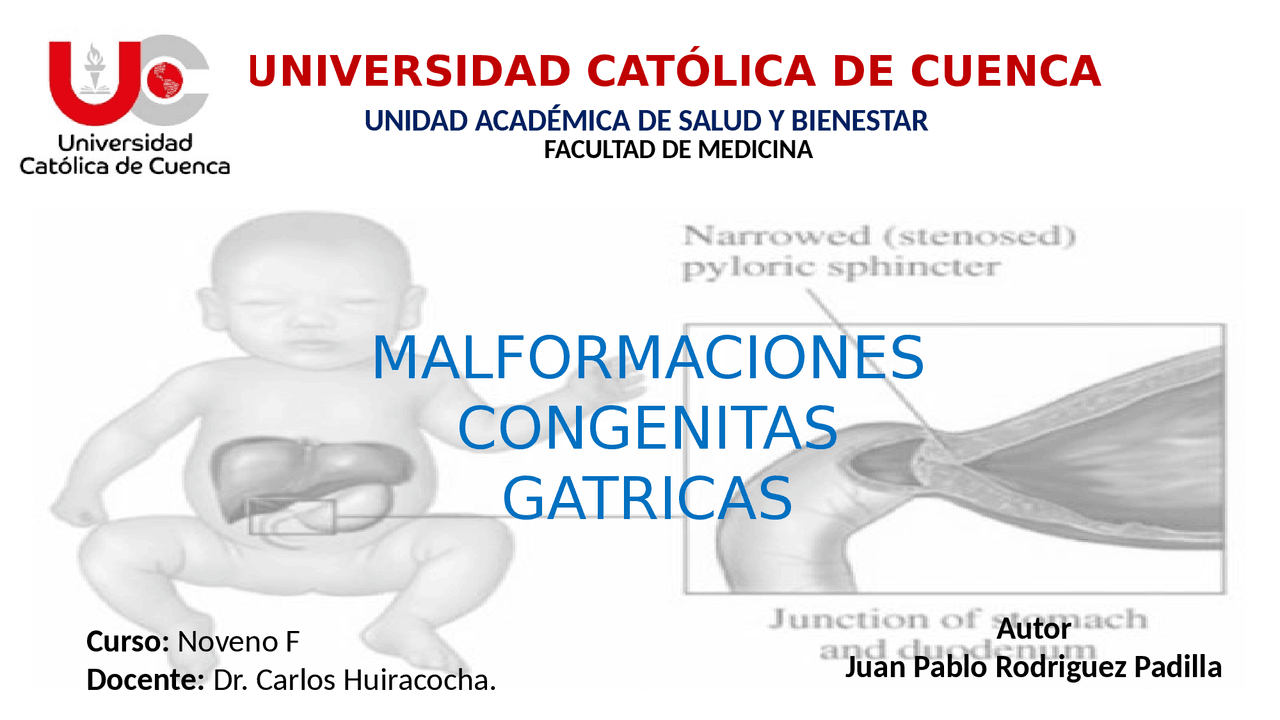 Malformaciones congenitas en pediatria - Docsity