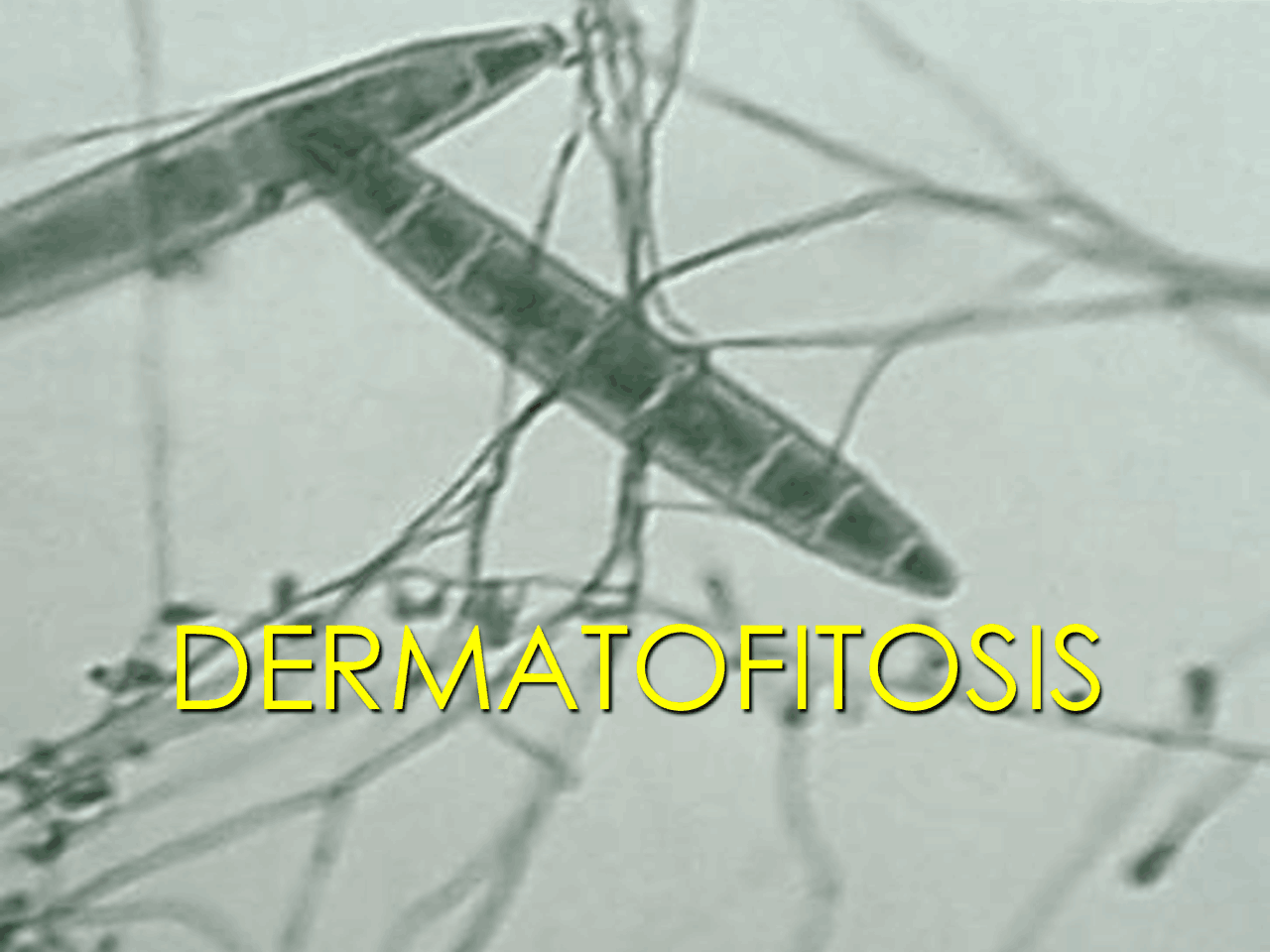 DERMATOFITOSIS DOCUMENTO - Docsity