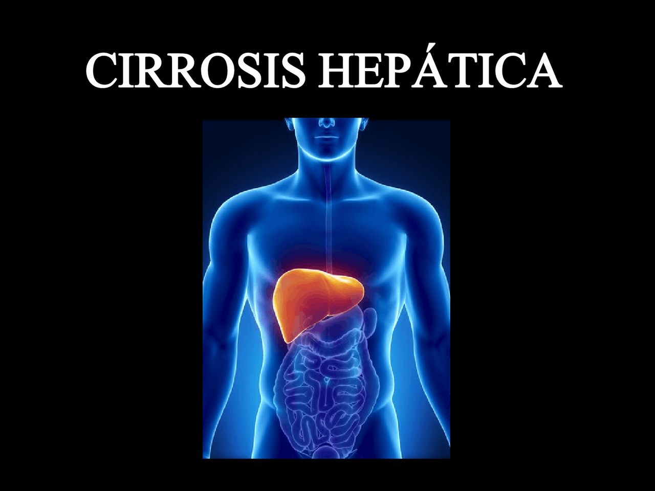 Cirrosis Hepática: Definición, Clasificación y Diagnóstico | Esquemas y mapas conceptuales de ...