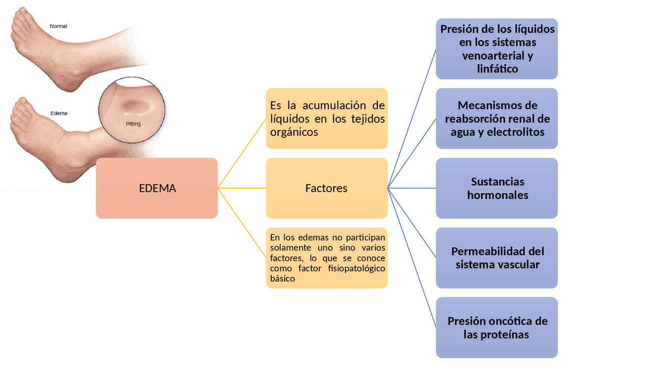 EDEMAS GENERALIDADES - Docsity