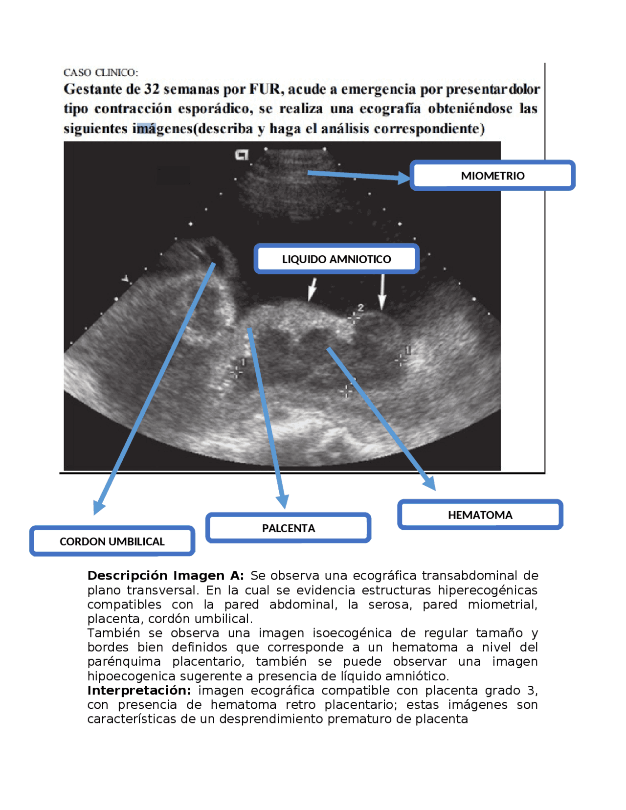 Caso ClÍnico En Ayuda Al Diagnostic Docsity