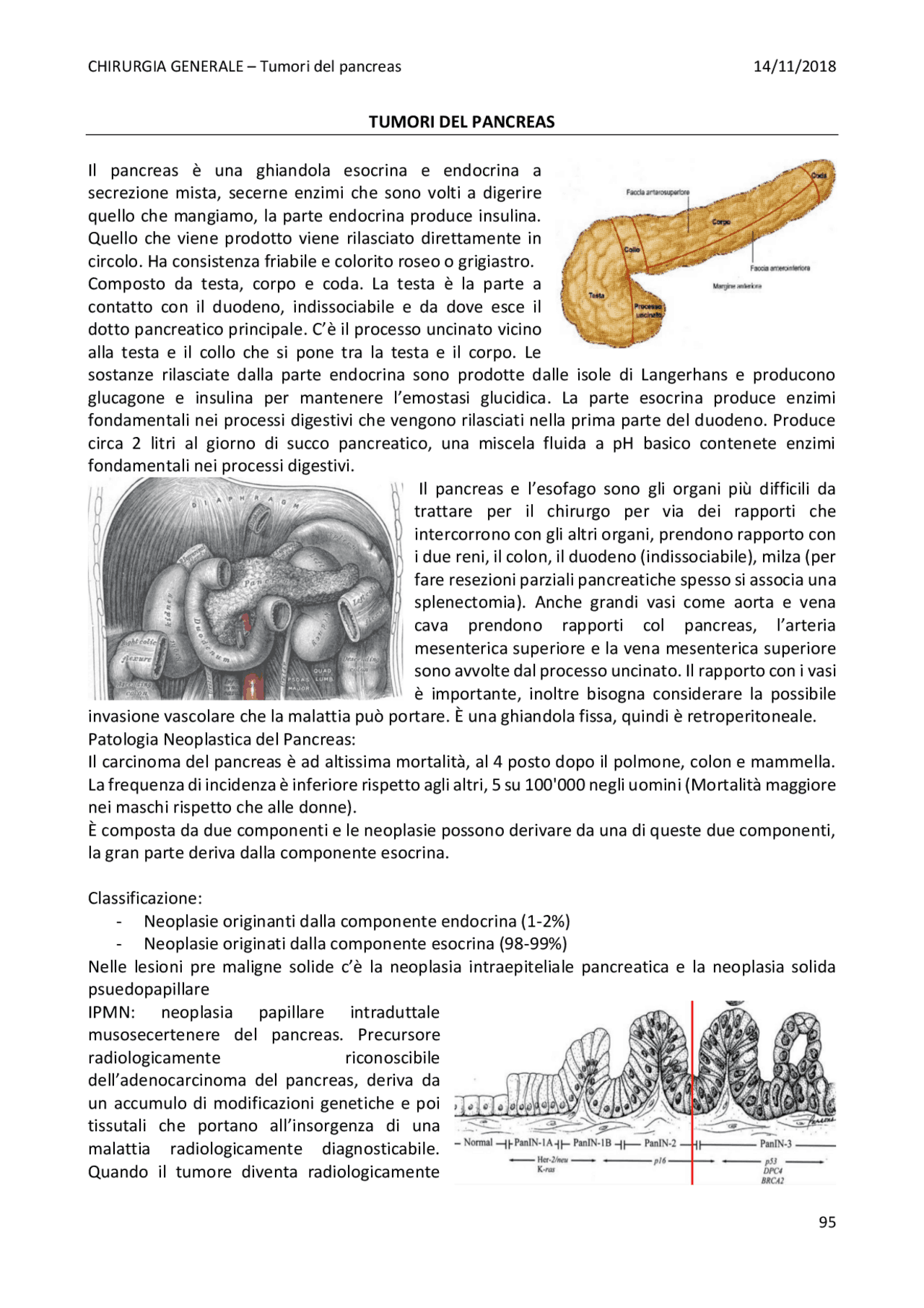CHIRURGIA GENERALE - Tumori del pancreas - Docsity