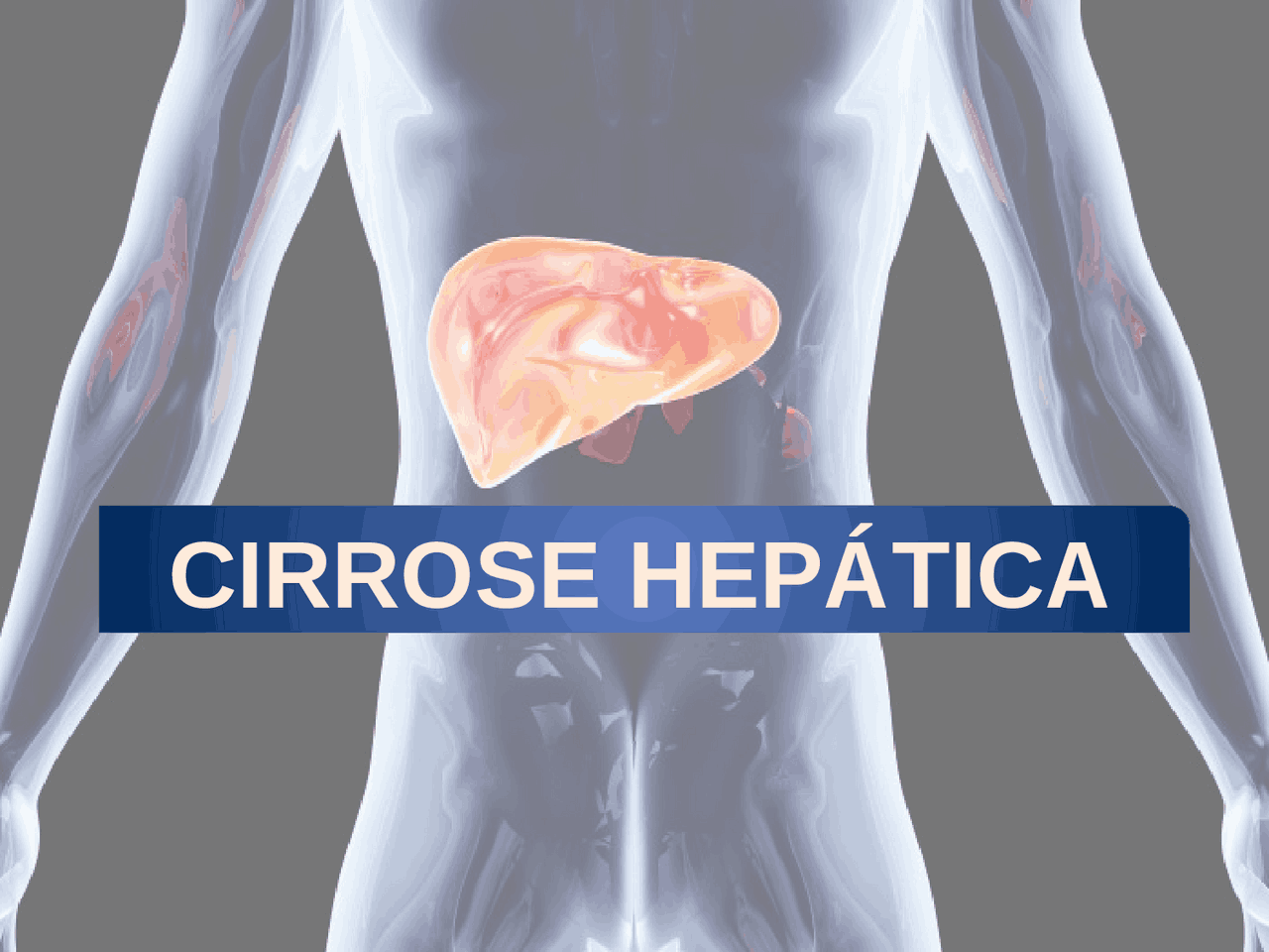 Cirrose Hepática e a assistência de enfermagem ao portador da patologia ...