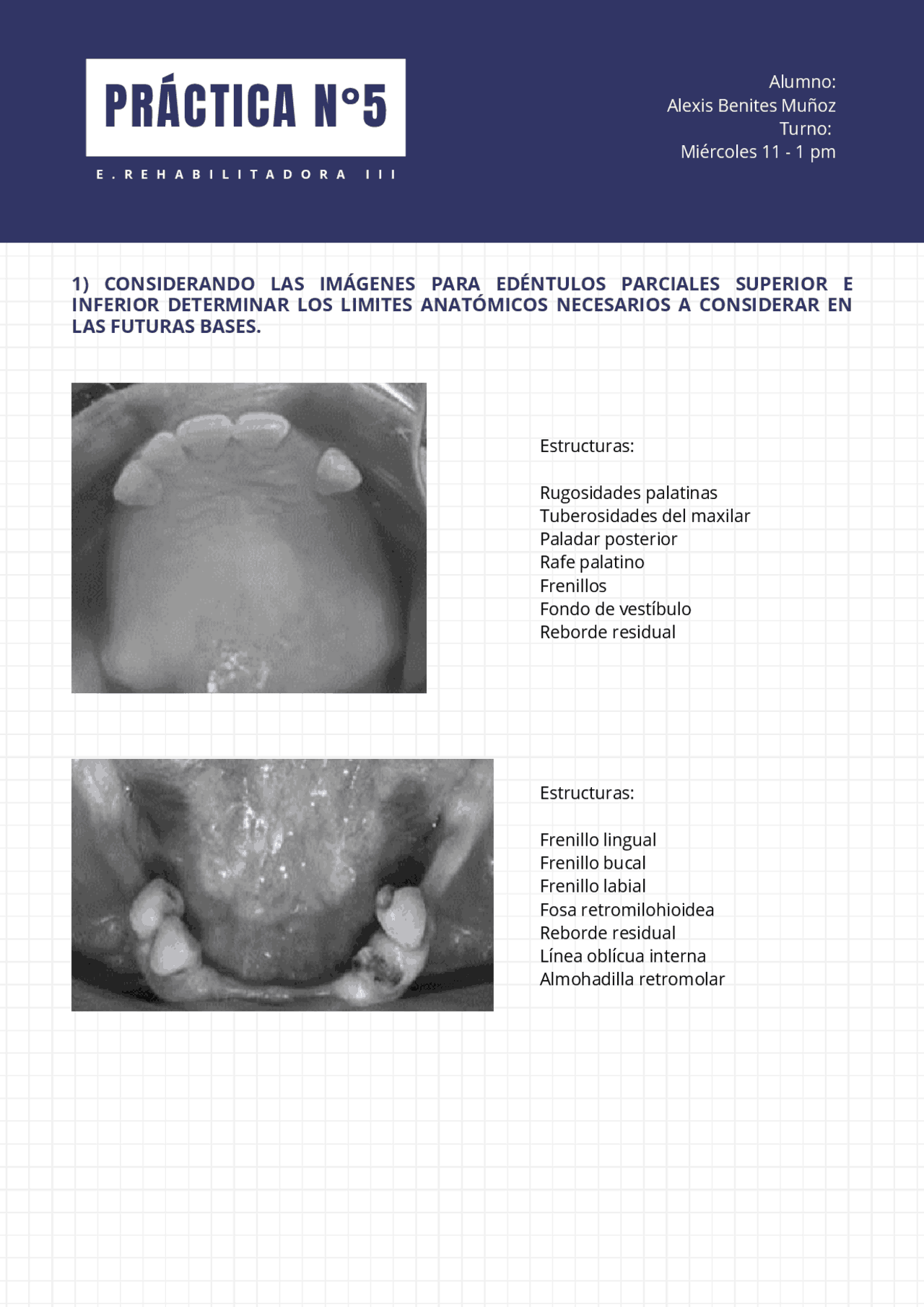 5. Bases y dientes en PPR - Docsity