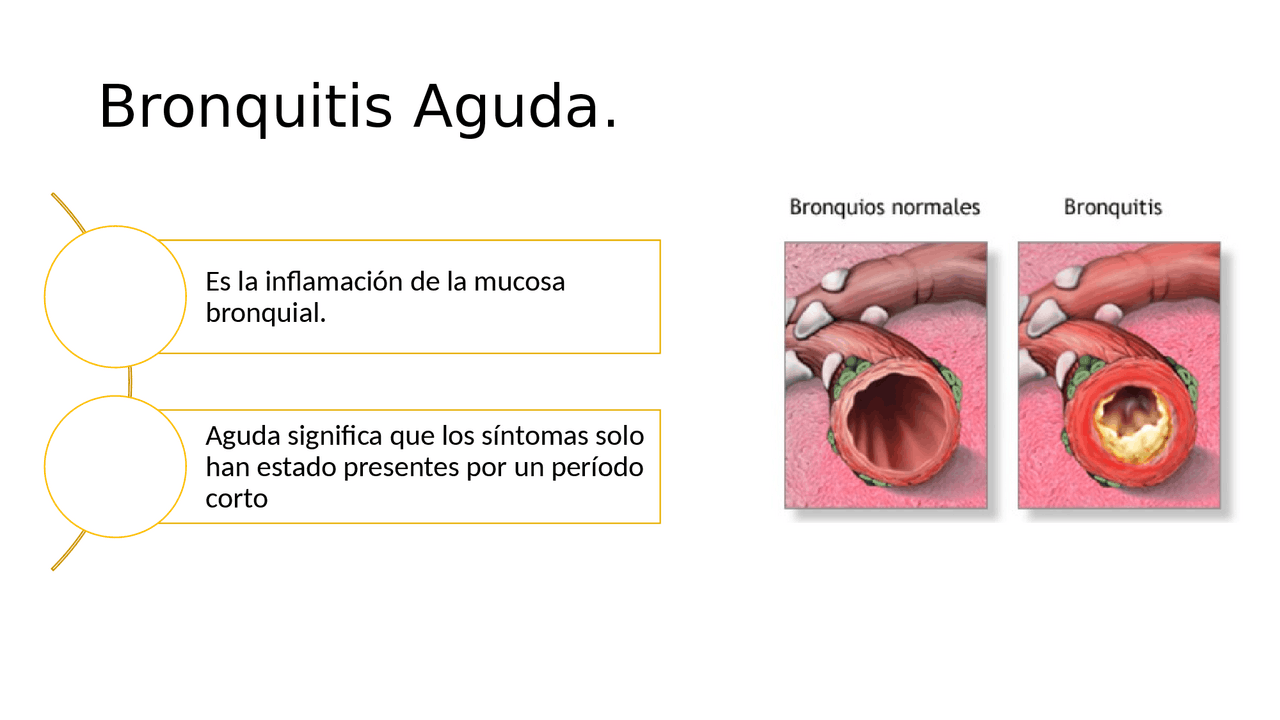 Bronquitis Aguda: Significado, Causas, Sintomas, Diagnóstico y ...