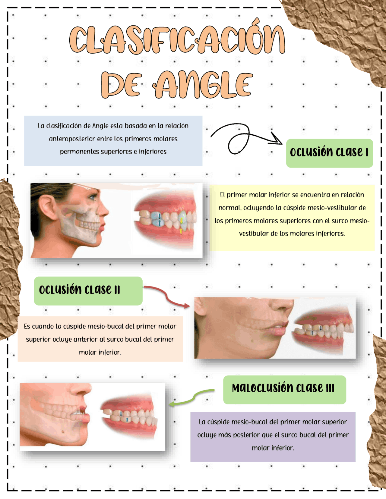 Clasificación de Angle - Docsity