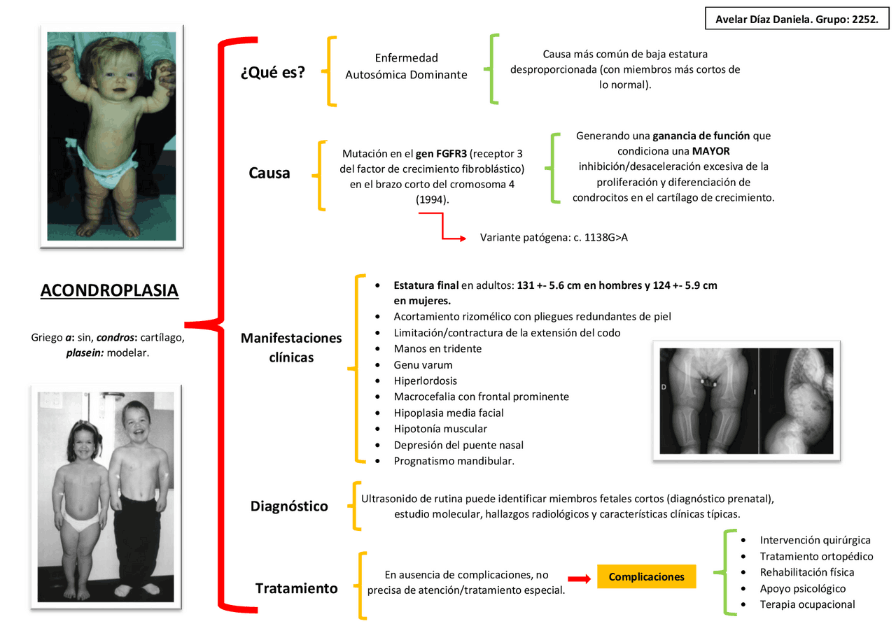 Diagrama De Acondroplasia Acondroplasia