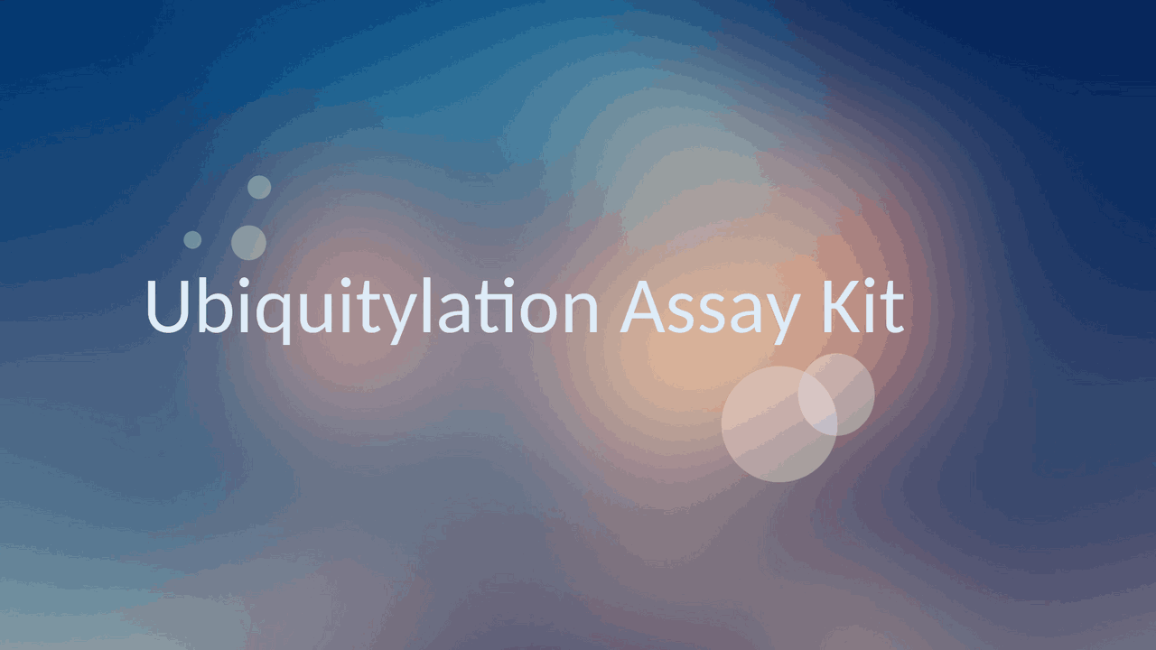 Ubiquitylation Assay Kit - Docsity