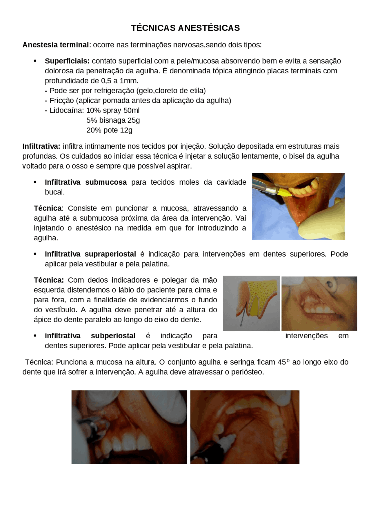 TÉcnicas AnestÉsicas Docsity
