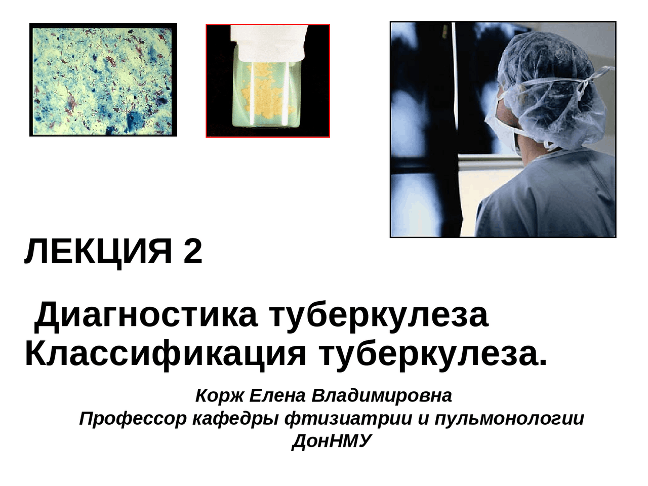 Туберкулёз лёгких Диссименированный Docsity