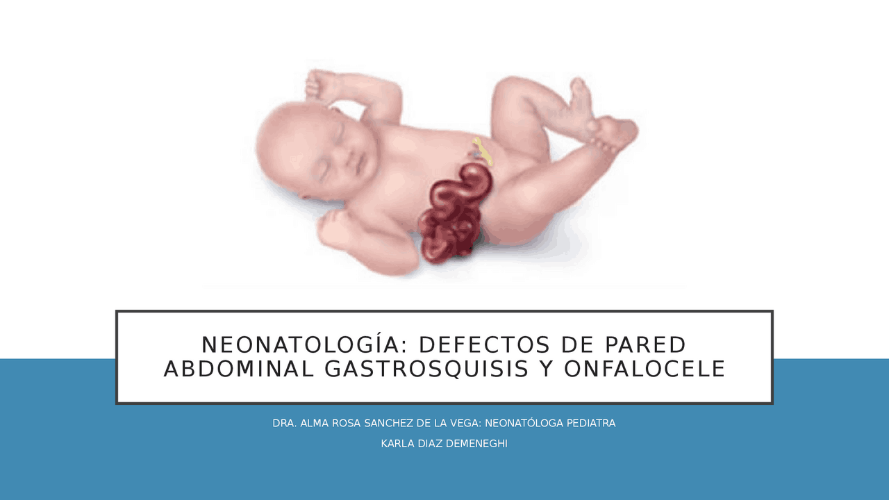 GASTROSQUISIS-ONFALOCELE Y ALGUNAS DIFERNECIAS | Diapositivas de ...