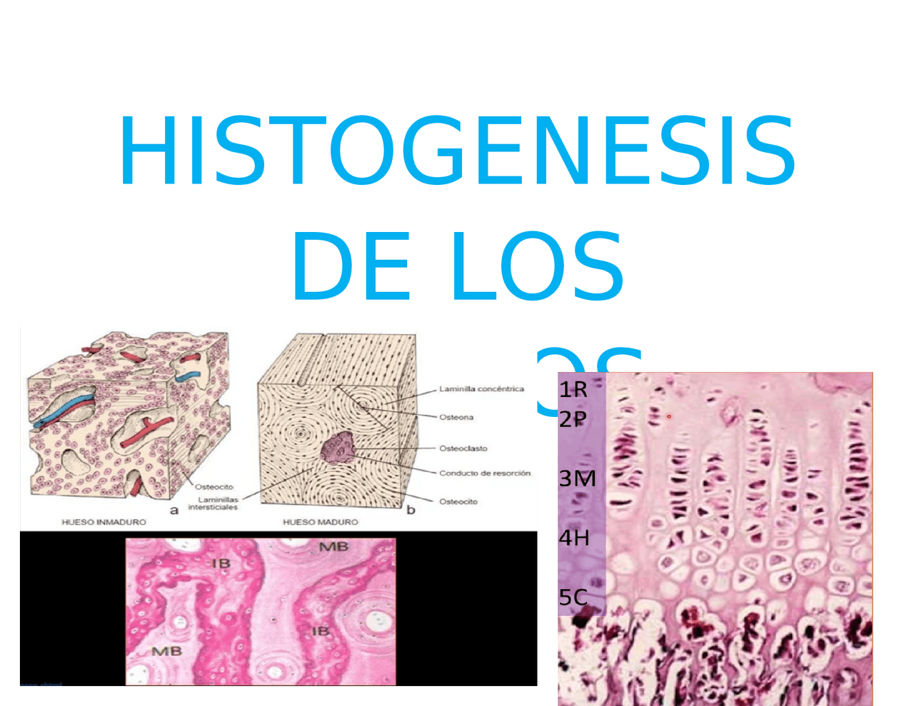 Imágenes de histogénesis de los huesos - Docsity