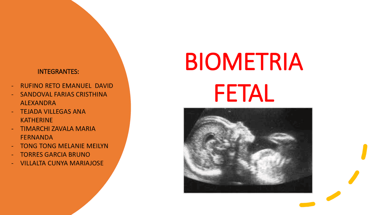 Embarazo Multiple Diapositivas Docsity