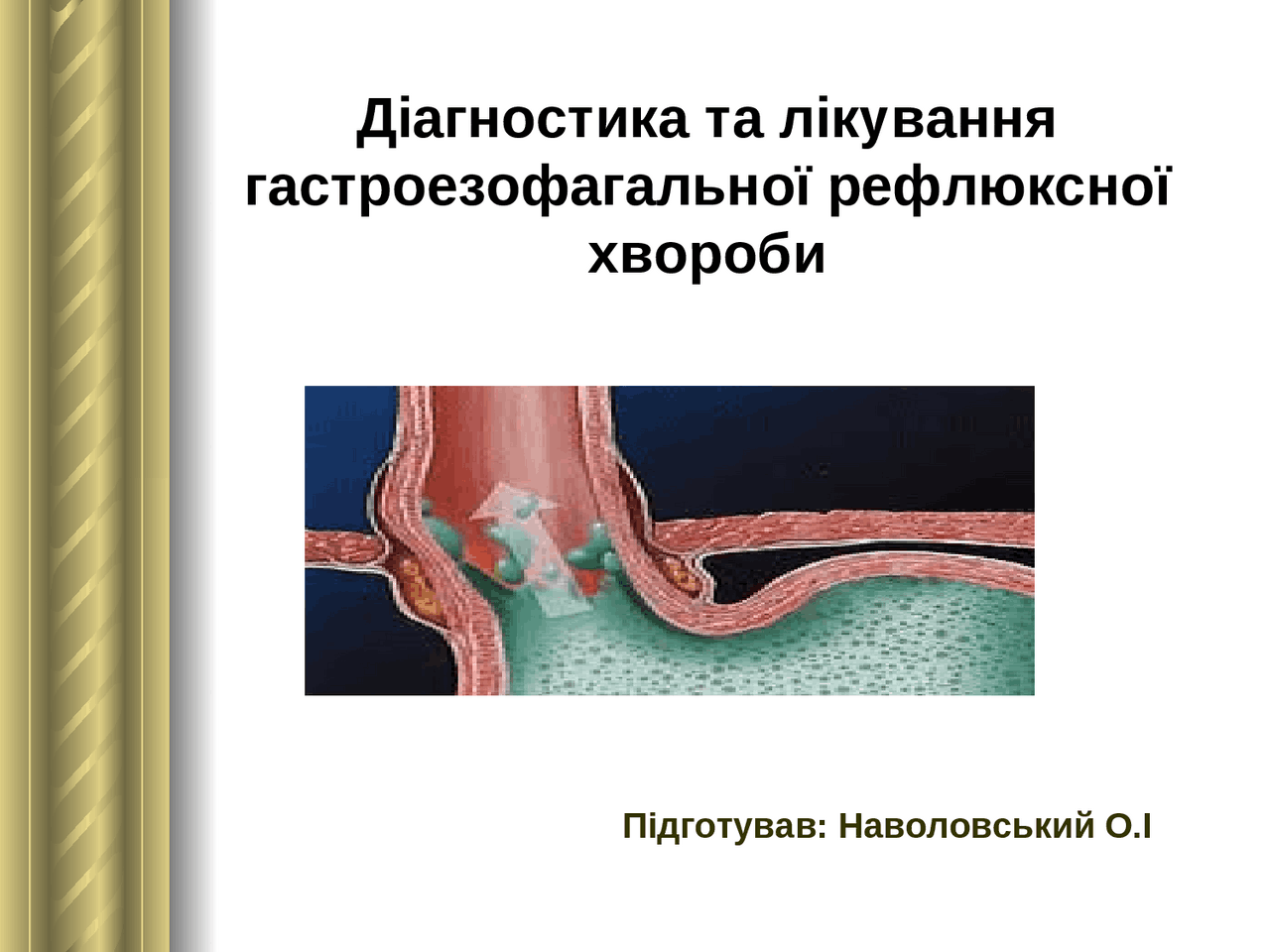 ГЕРХ діагностика і лікування Docsity