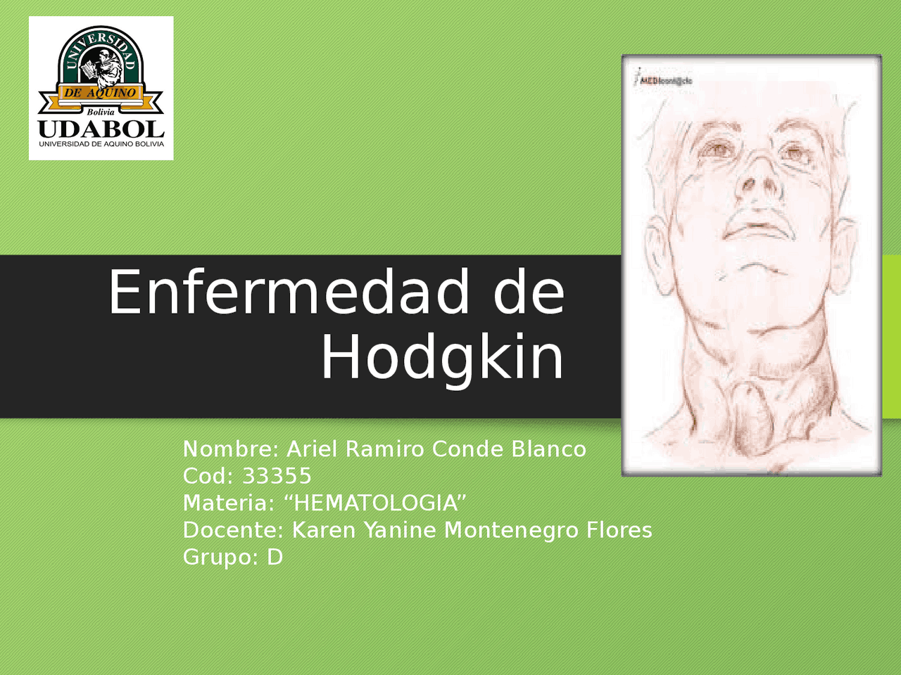 Enfermedad De Hodgkin Docsity