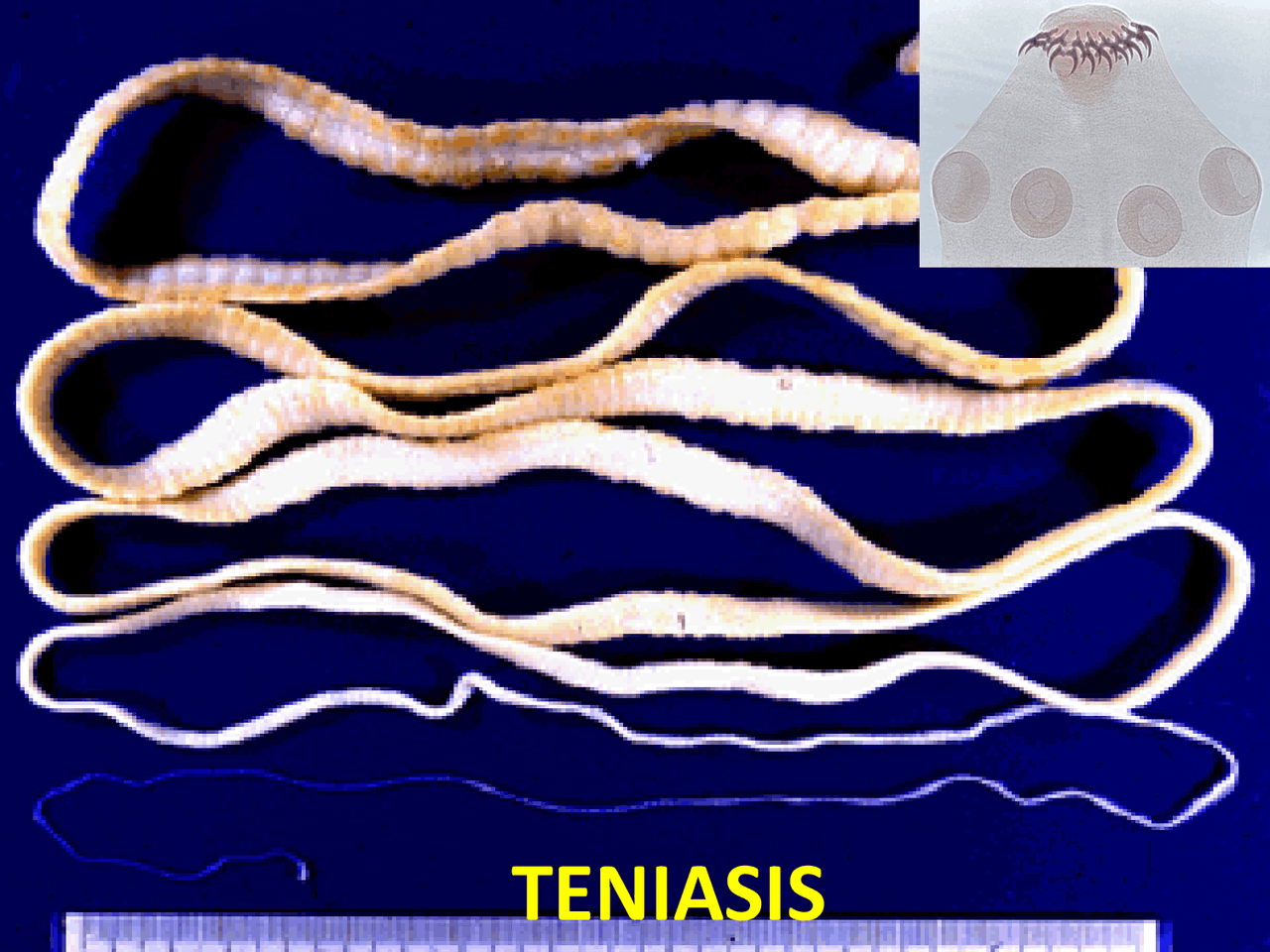 TAENIDAE-HYMENOLEPIDAE-ANOPLOCEPHALIDAE - Docsity
