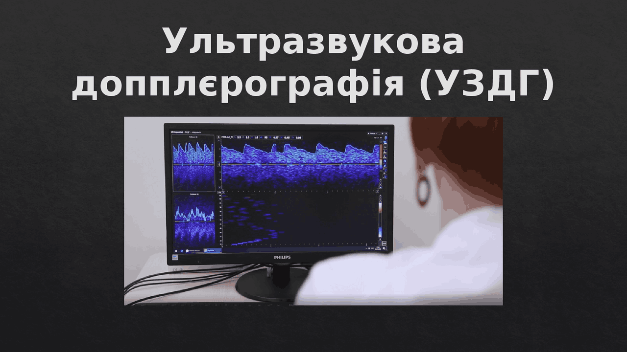Ультразвукова допплєрографія УЗДГ Docsity