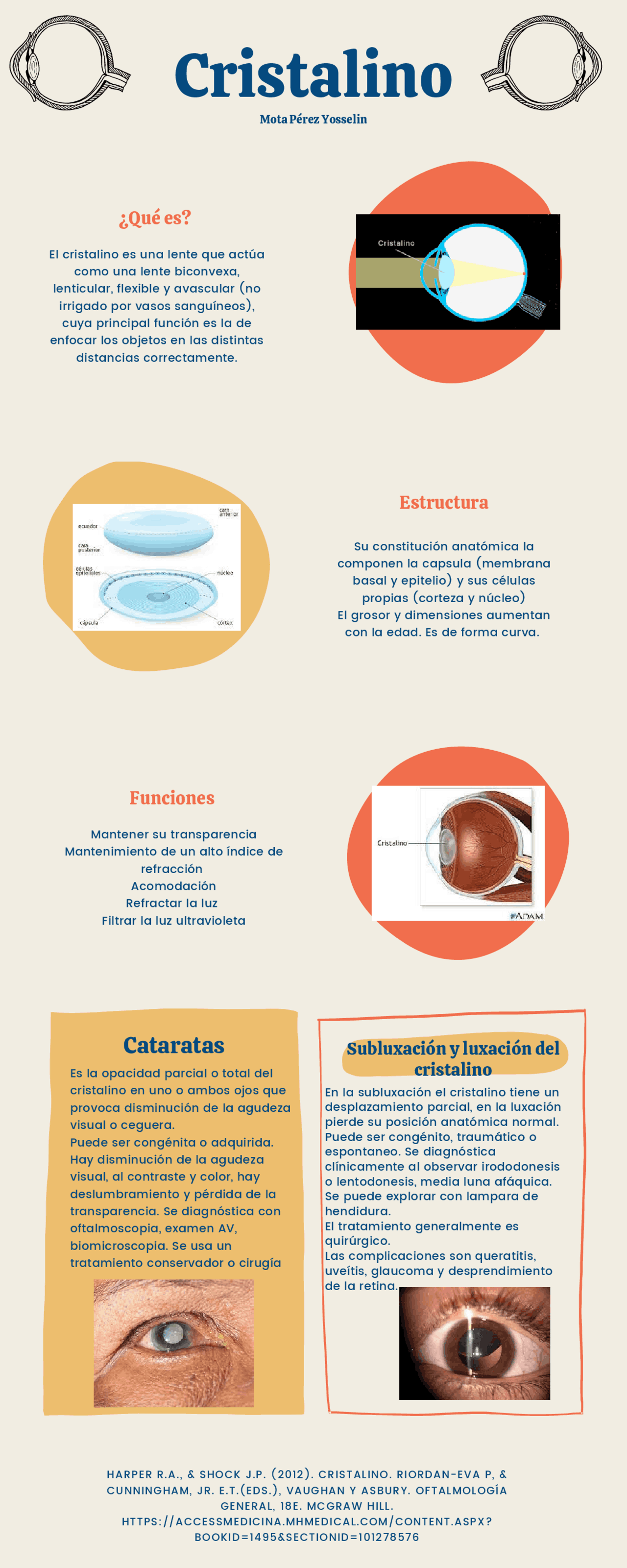 Infografia De Oftalmologia Docsity