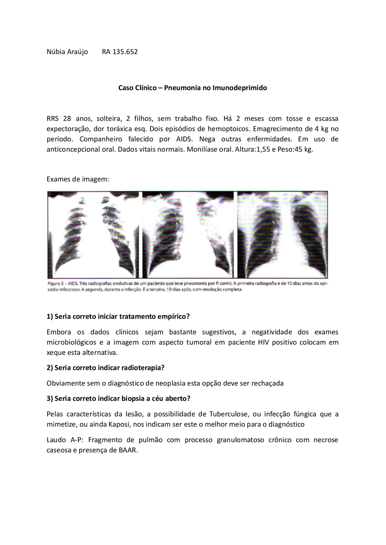 Caso Clínico Doenças Respiratórias Docsity