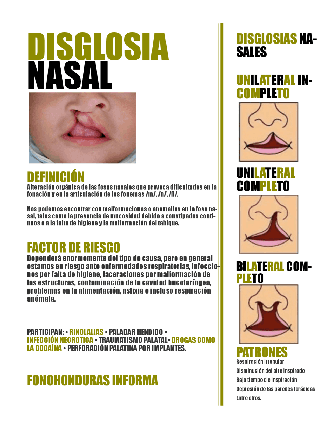 Disglosia Nasal en fonoaudiología - Docsity