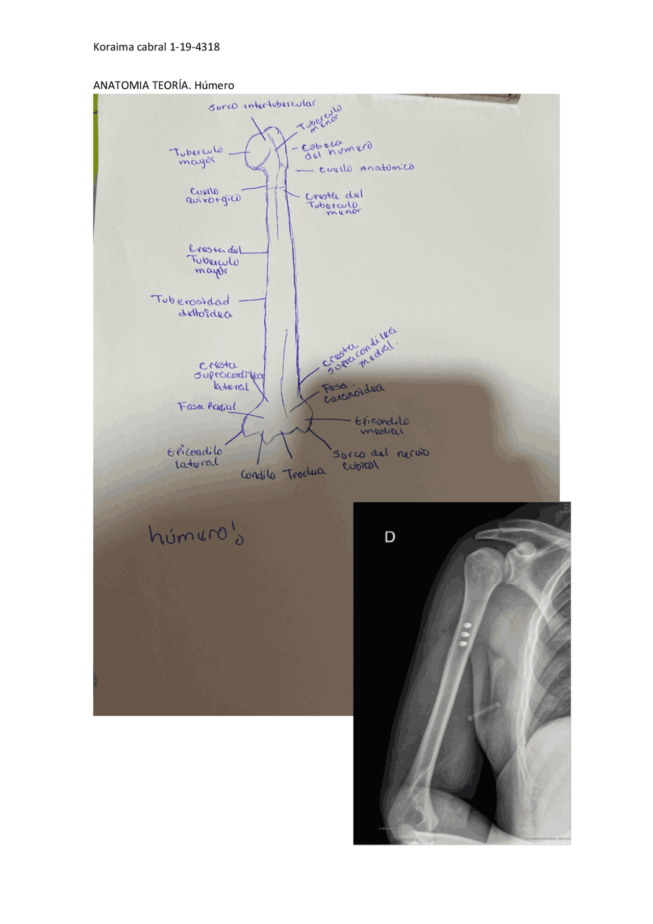 Anatomia 1, el húmero y sus partes. - Docsity