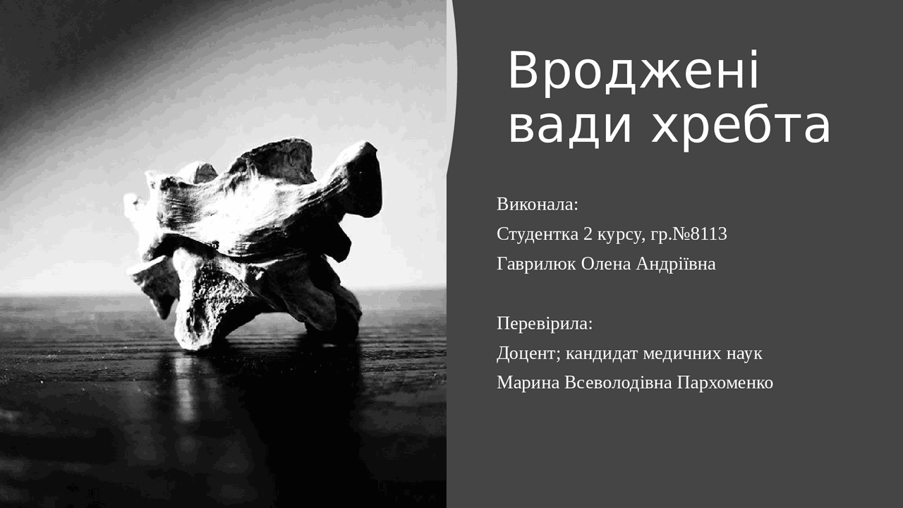 Переломы травмы деформации позвоночника дефекты сна Docsity