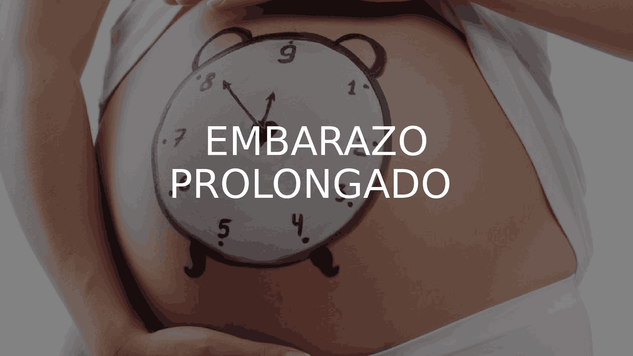 Embarazo prolongado en obstetricia - Docsity