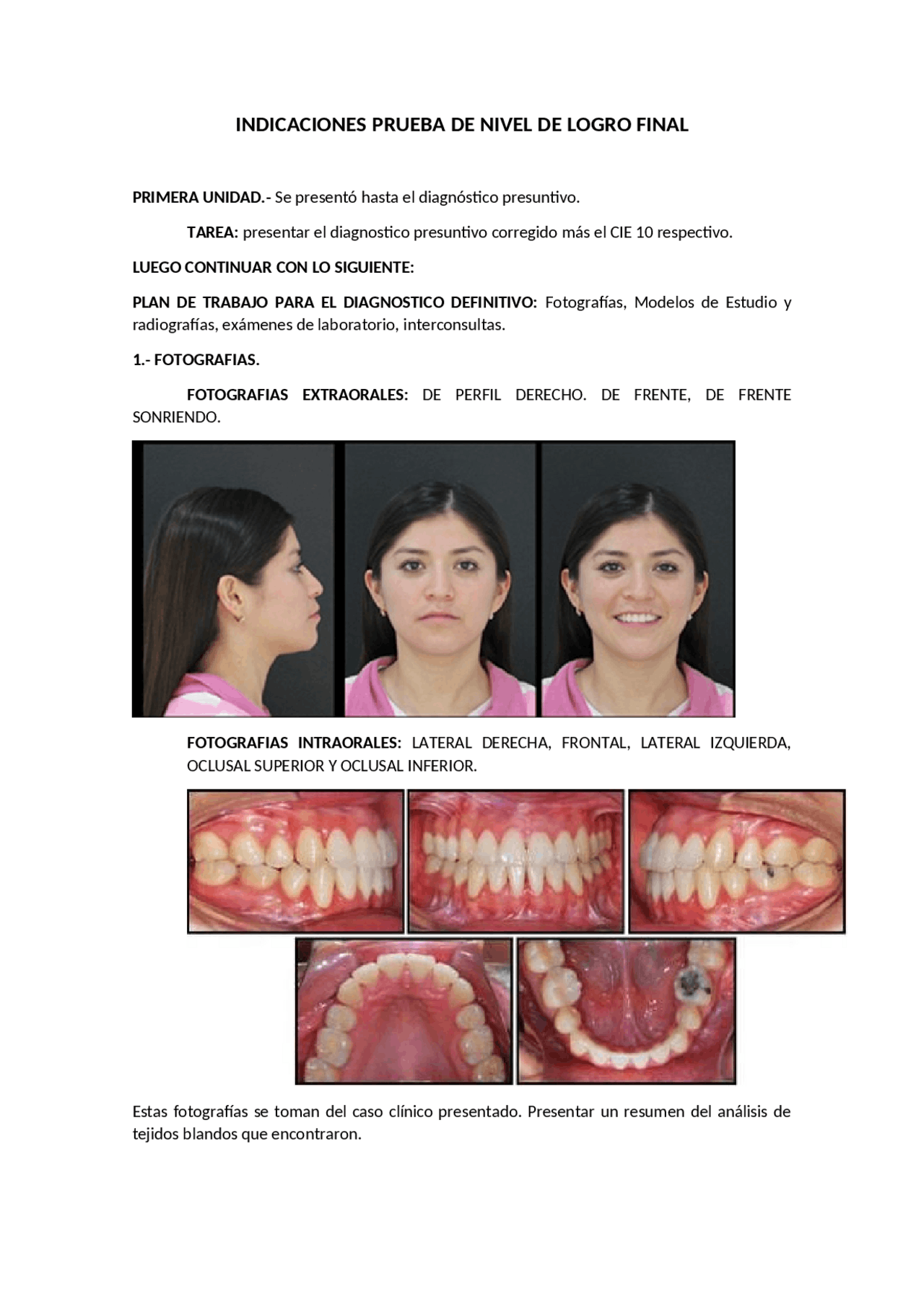 Protusion mandibular en caso clinicio - Docsity