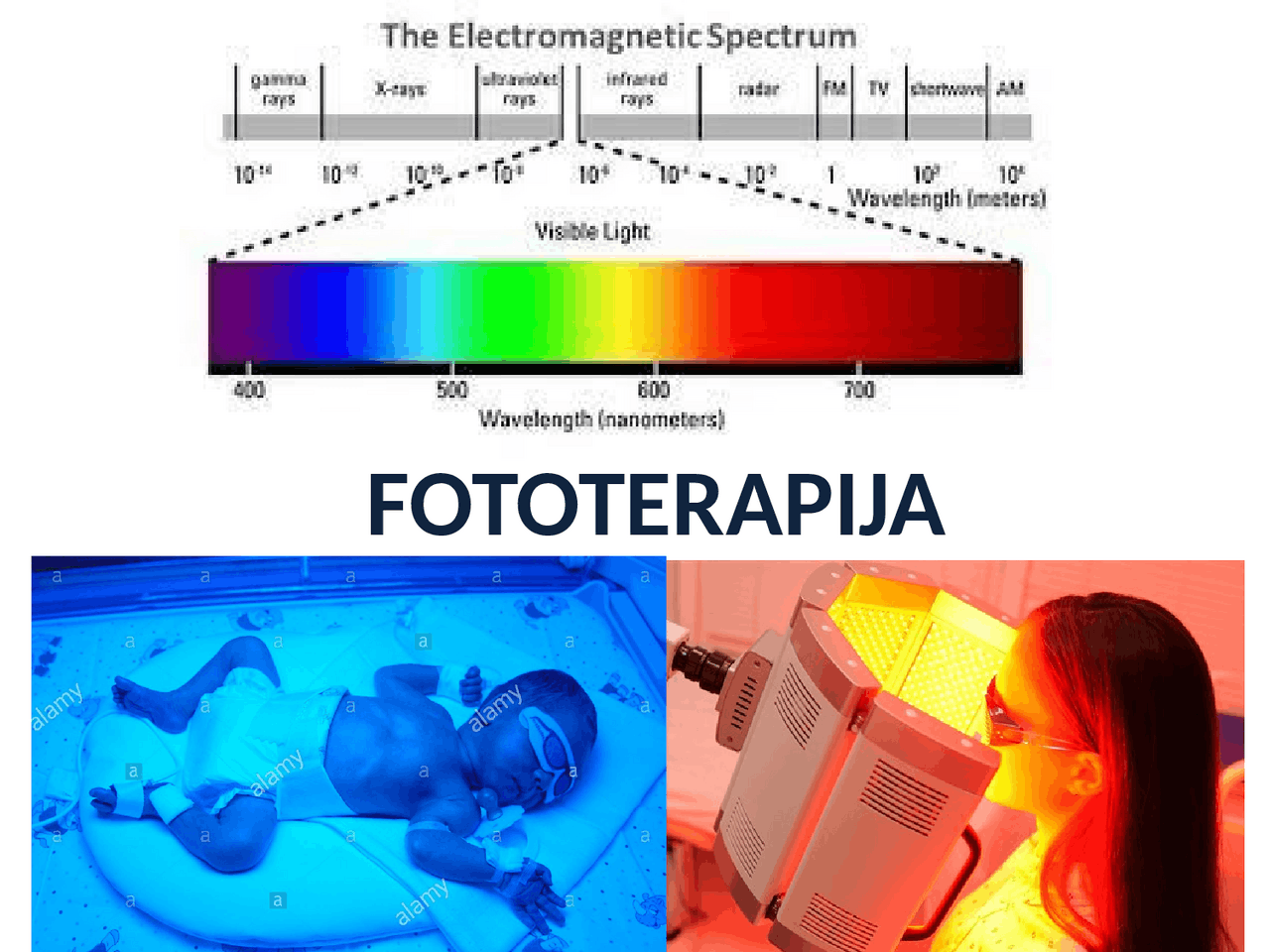 FOTOTERAPIJA u fizikalnoj medicini i rehabilitaciji | Slajdovi' predlog Fizikalna medicina i ...