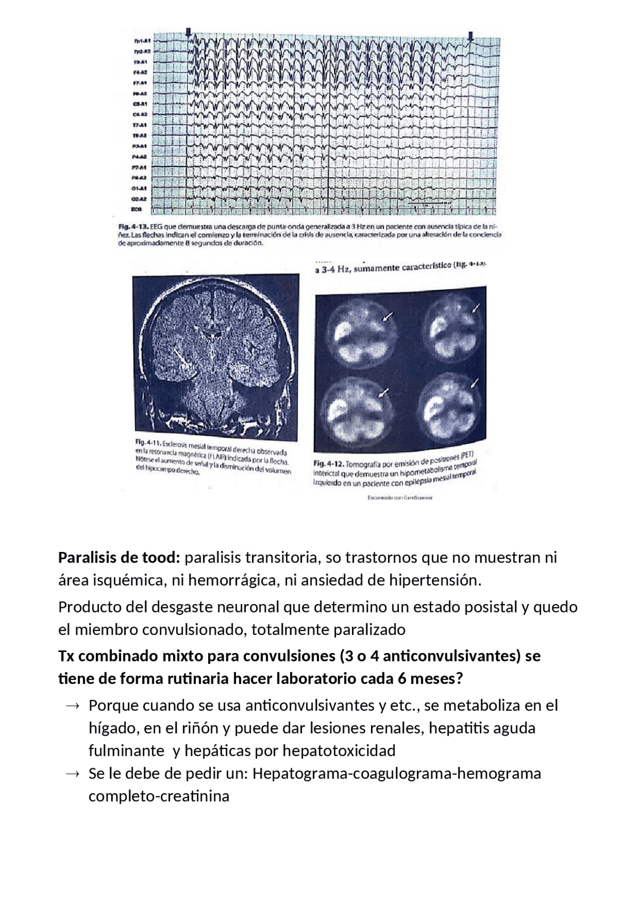 Resumen De Neurología Y Neurociencias Cefaleas Docsity