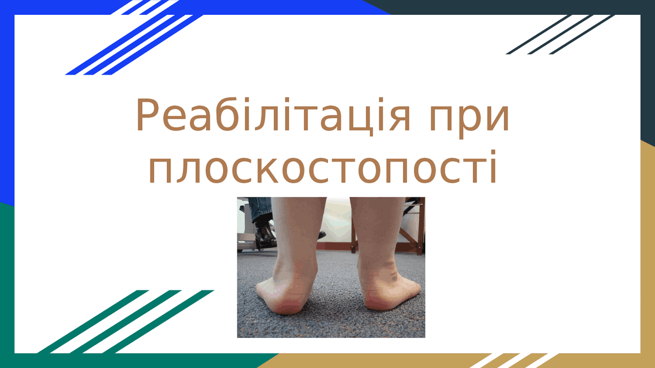 Реабілітація при плоскостопості Схемы Терапия Docsity