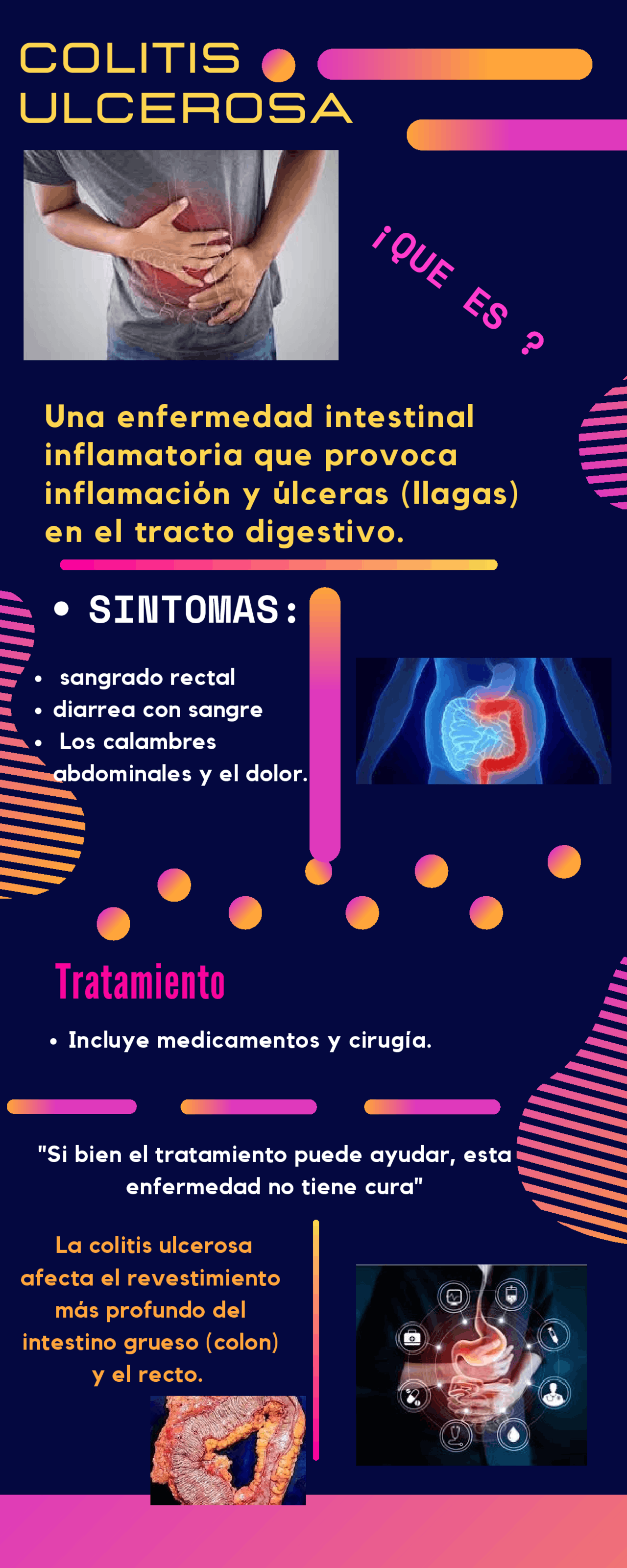 Afiche de colitis ulcerosa - Docsity