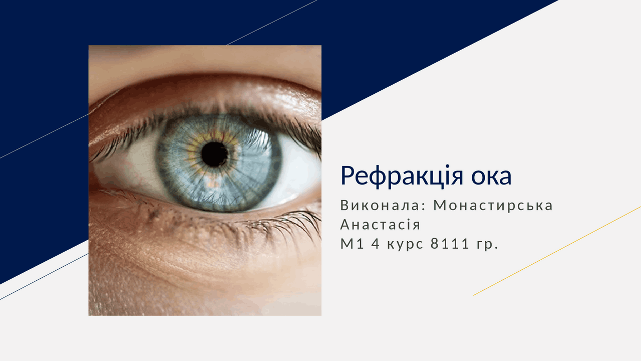 Рефракція ока офтальмологія Docsity