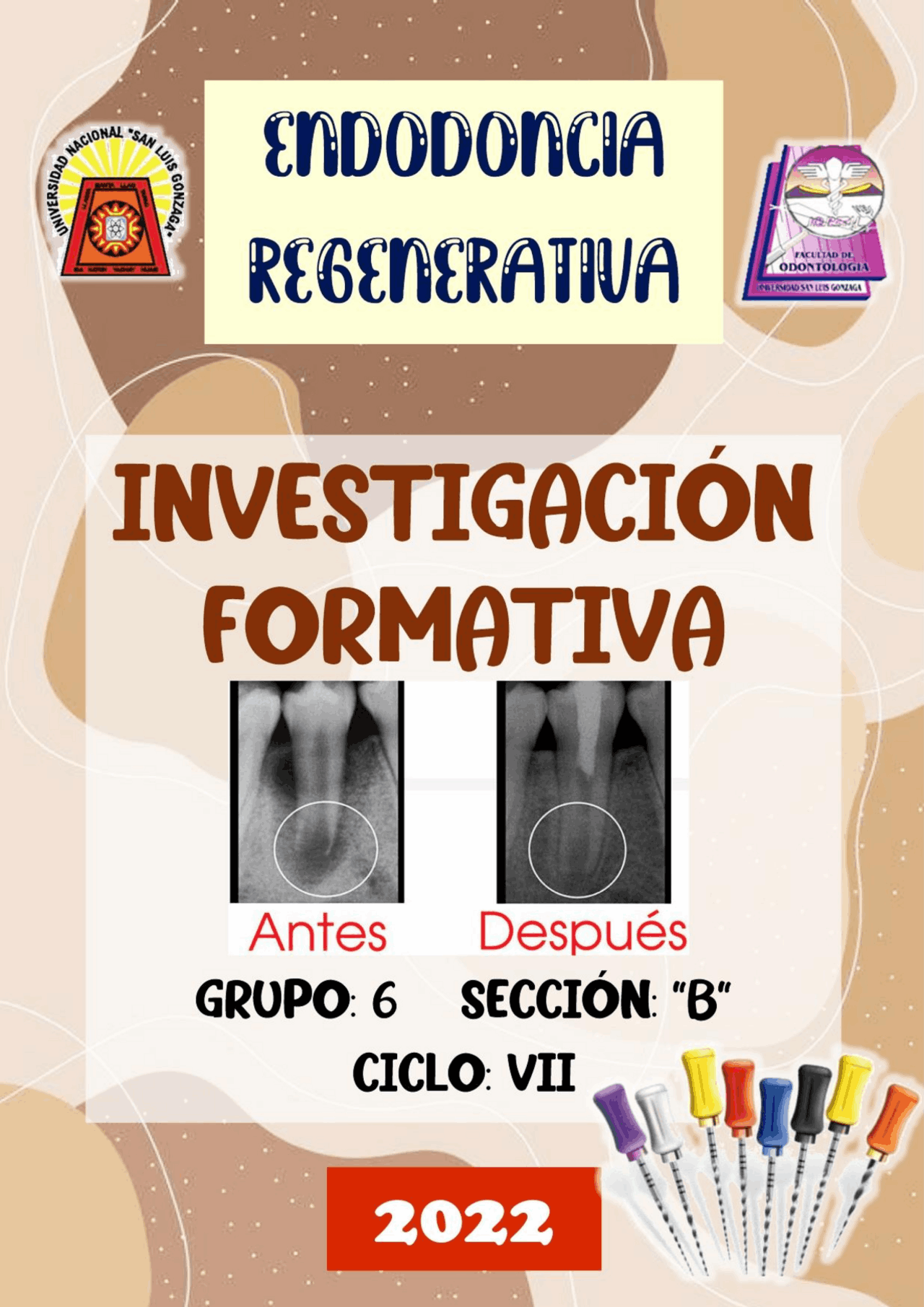 Endodoncia Regenerativa Lectures De Endodontie Docsity