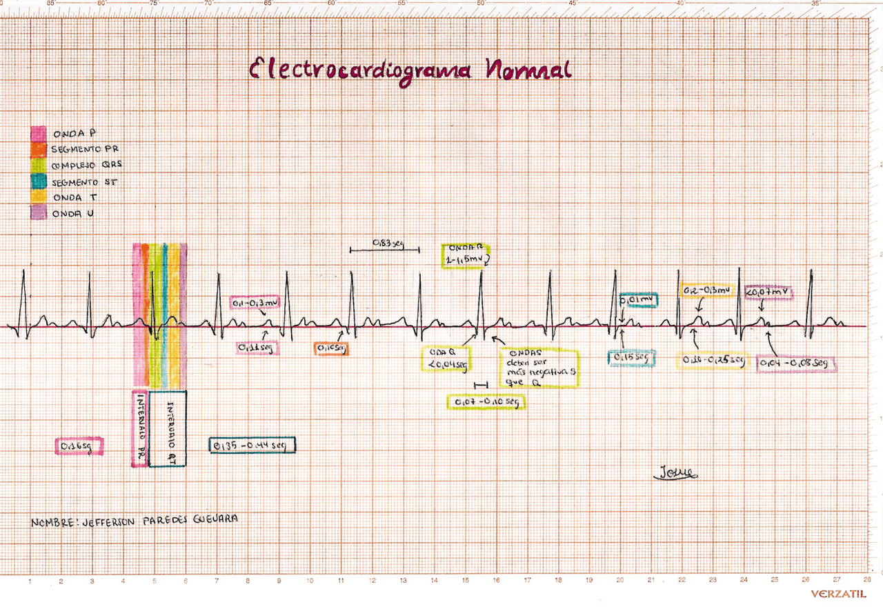 Electrocardiograma y sus partes - Docsity