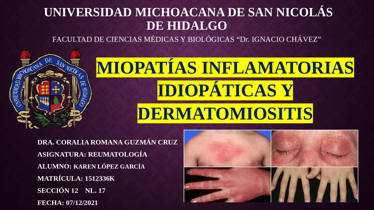 MIOPATÍAS INFLAMATORIAS IDIOPÁTICAS Y DERMATOMIOSITIS | Diapositivas de ...