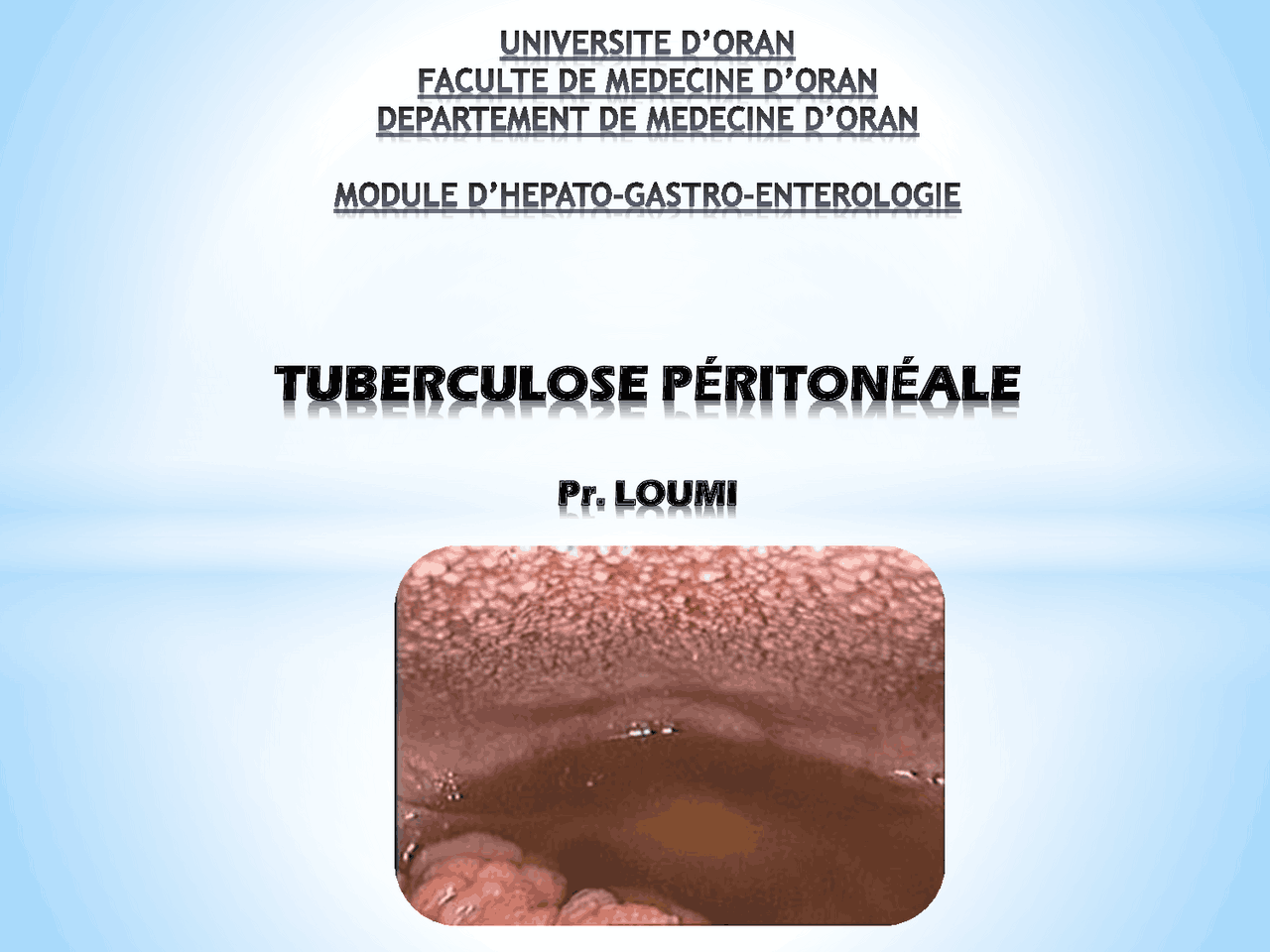 Tuberculose péritonéale - Docsity