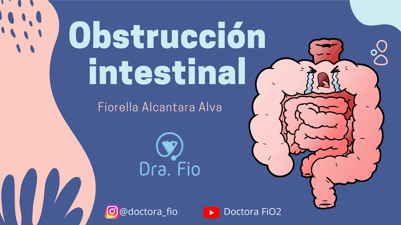 Presentación de Obstrucción Intestinal | Esquemas y mapas conceptuales ...