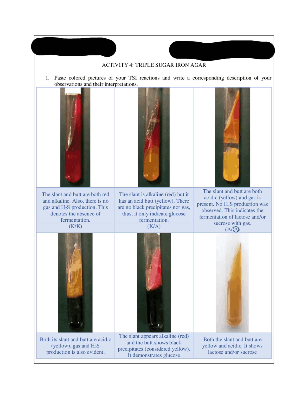 Tsi Slant Interpretation Chart1: Laboratory Approach To Etiological