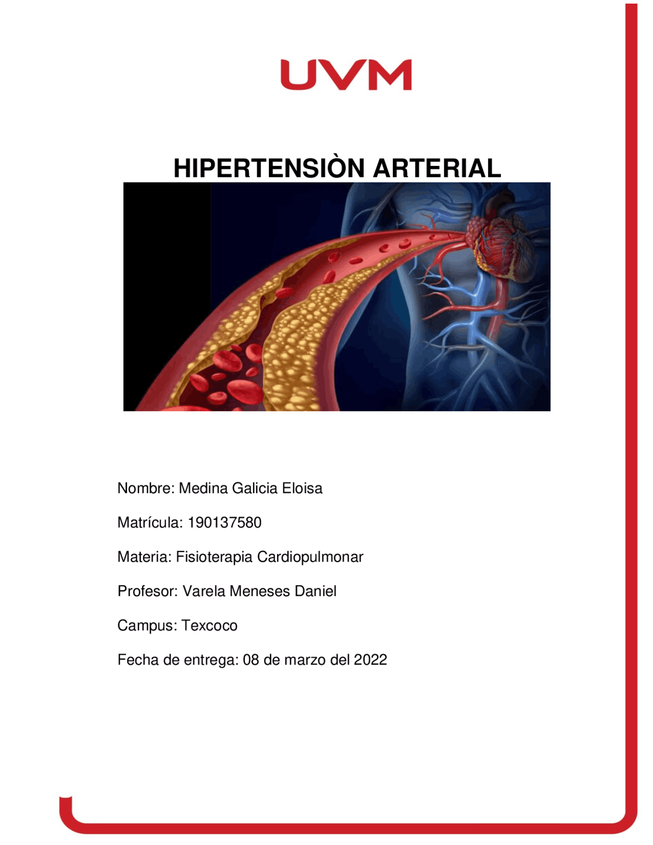 HipertensiÓn Arterial Resúmenes De Fisioterapia Docsity