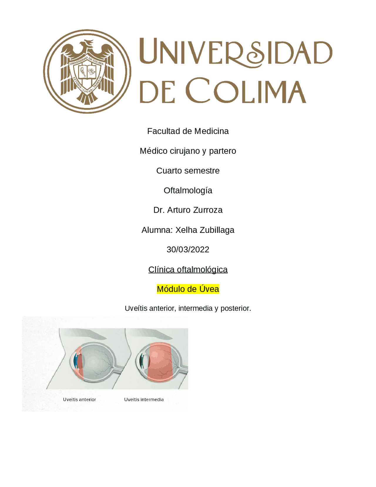Resumen De Oftalmología Temas De Clase Docsity