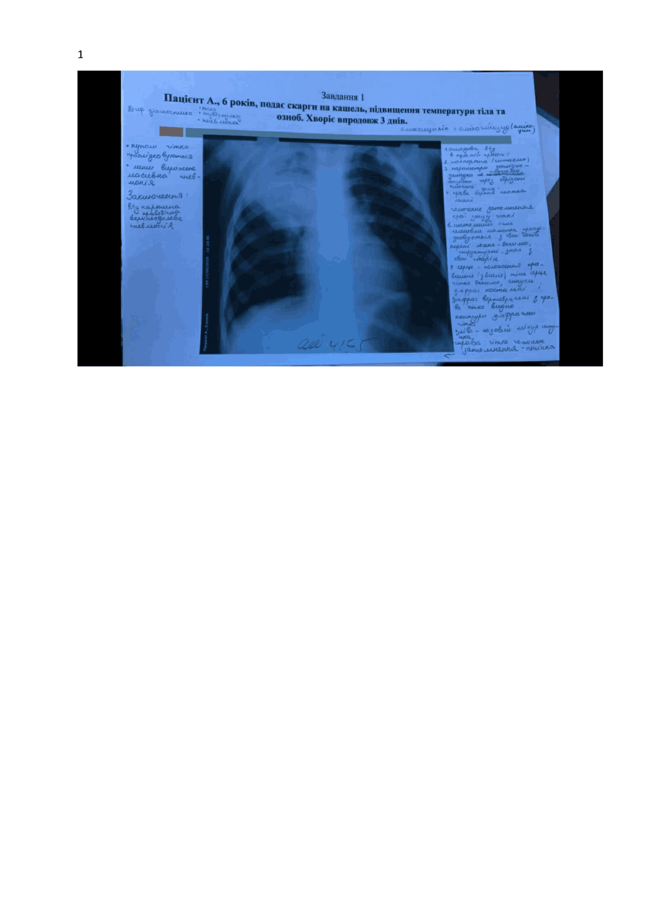 Its rtg for pediatrics - Docsity